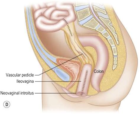 Gender Affirming Genitourinary Surgery And Associated Care Physician