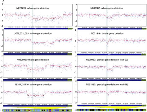 Spectrum Of Scn1a Gene Mutations Associated With Dravet Syndrome Analysis Of 333 Patients Spectrum Of Scn1a Gene Mutations Associated With Dravet Syndrome Analysis Of 333 Patients