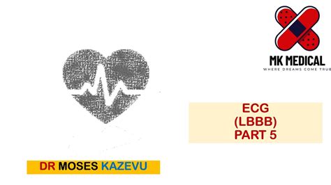 Ecg Lbbb Part 5 Youtube