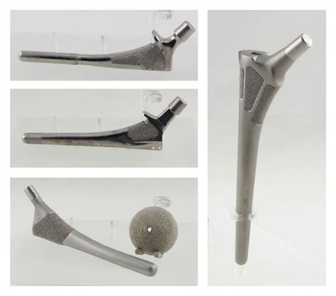 Early Press Fit Implants · Yale University Library Online Exhibitions