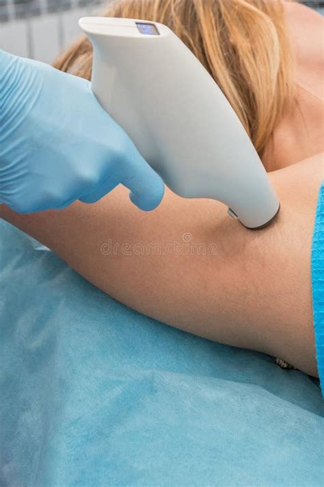 Procedure Against Hyperhidrosis Stock Image Image Of Female Health