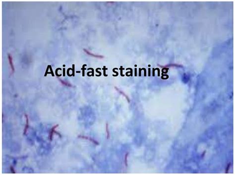 Acid Faststaining For Differentiate Acid Fast Bacteria Pptx