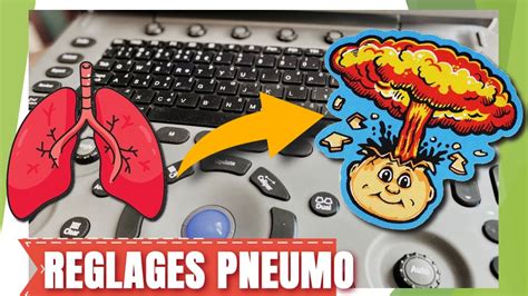 Réglage De Léchographe échographie Pulmonaire Youtube