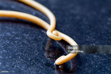 Ascariasis Adalah Penyakit Yang Disebabkan Oleh Cacing Gelang Parasit Ascaris Lumbricoides Untuk