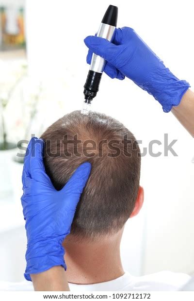 Scalp Microneedling Images Stock Photos Vectors Shutterstock