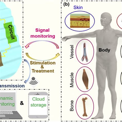 Pdf Flexible Bioelectronics For Physiological Signals Sensing And Disease Treatment