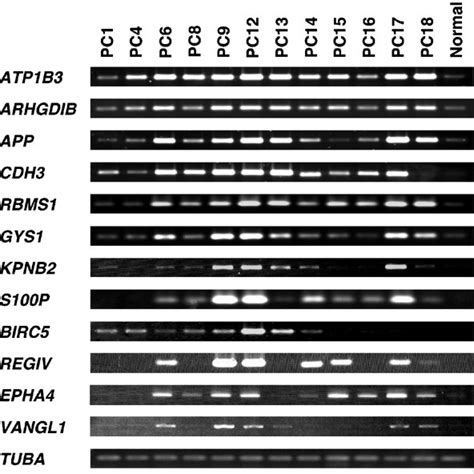 Confirmation Of Reliability Of The Microarray Data Expression Of 12 Download Scientific
