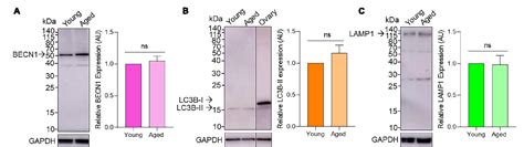 Figure 1 From The Impact Of Aging On Macroautophagy In The Pre