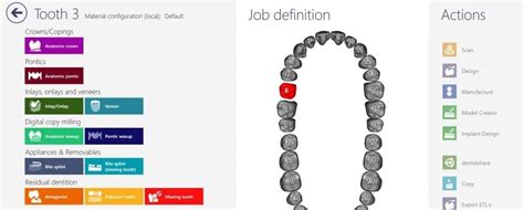 CAD Ray Design Software Powered By Exocad CAD Ray Com