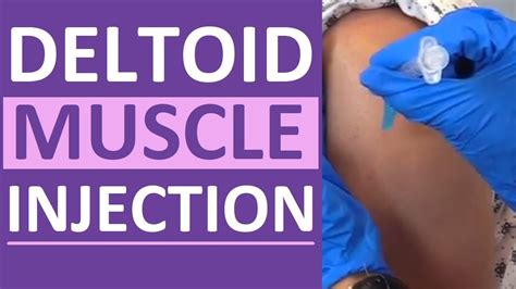 Deltoid Muscle Injection