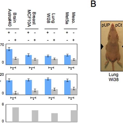 The Dnmt1 Pcna Uhrf1 Disruption In Brain Lung Mammary And