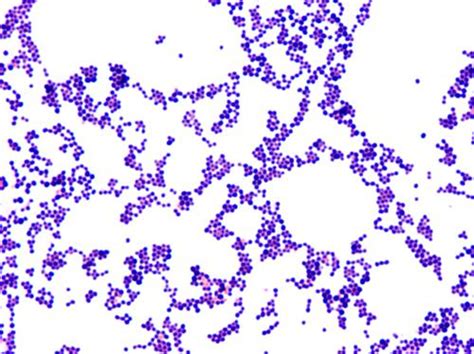 Micrococcus Luteus Acid Fast Stain