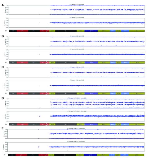 Snp Array Analysis On Placenta And Fetal Tissues Of Case 1 A
