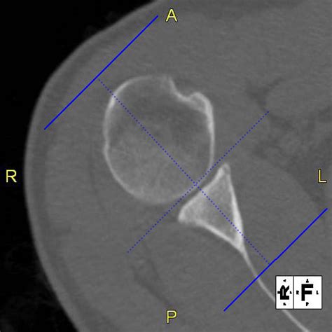 Msk Ct Protocols