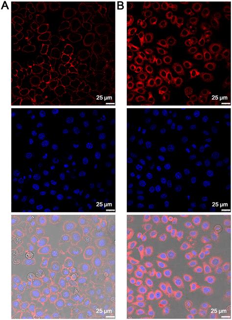 Targeted Laptm4b Protein Imaging In Hepg2 Cancer Cells Confocal Images