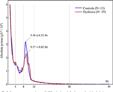 Figure 1 From Graph Analysis Of Eeg Resting State Functional Networks