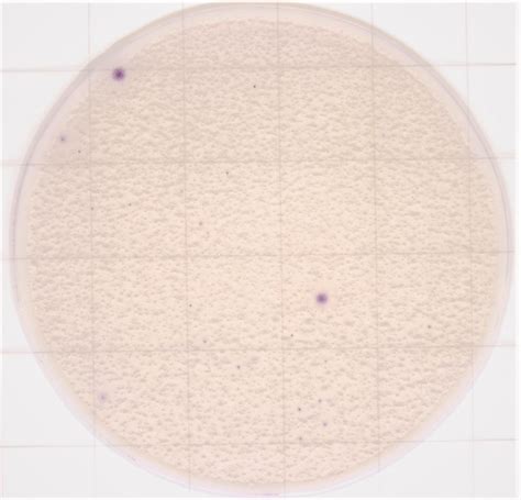Easy Plate Ym R｜test Kit Kikkoman Biochemifa Company