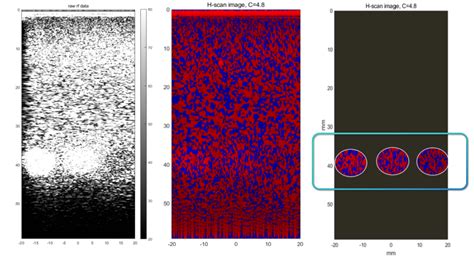 用凌烟阁高精度计算板卡加速hscan成像 Lyg Semi 用凌烟阁高精度计算板卡加速hscan成像 Lyg Semi