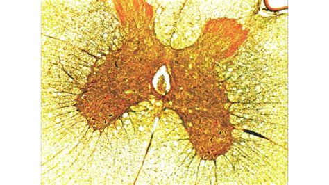 Solved Which Picture Shows Both White And Gray Matter The