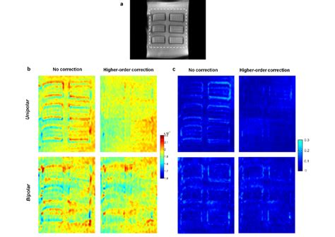 Fractional Anisotropy Fa And Mean Diffusivity Md At Various Levels