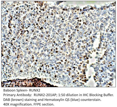 Runx2 Polyclonal Antibody Runx2 201ap Runx2 Polyclonal Antibody Runx2 201ap