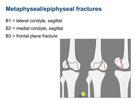 Ao Classification Ppt Ao Classification Ppt