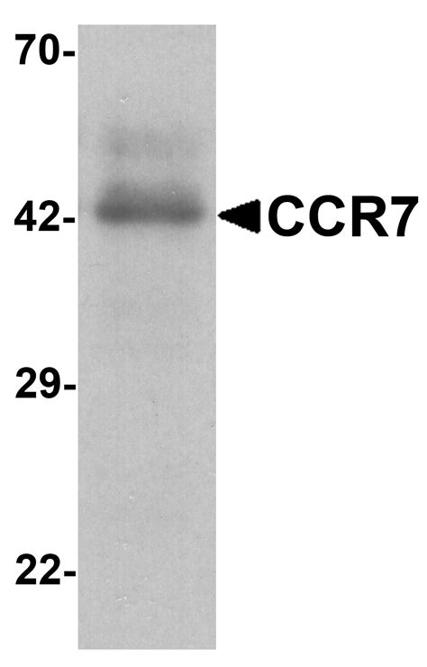 Ccr7 Antibody Cat No 7649 Prosci