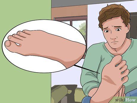 How To Prevent Hammer Toe Steps With Pictures WikiHow Health