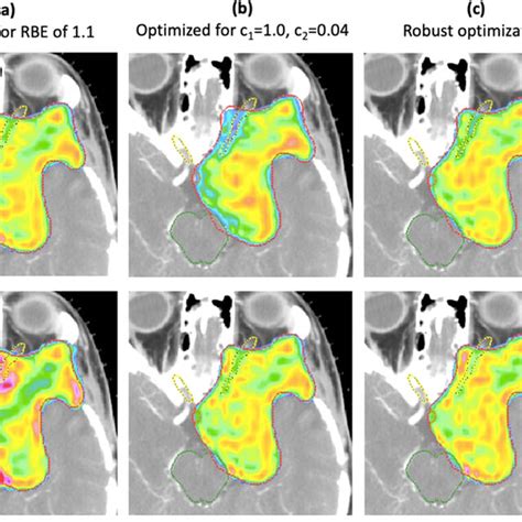Illustration Of Stochastic Programming Applied To Parameter Uncertainty