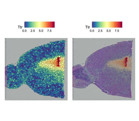 空间转录组分析工具 Seurat介绍 尖端生物科技