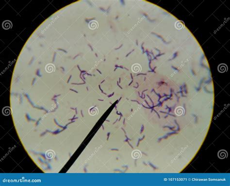 Bacteria Cells Finding With Microscope Stock Image Image Of