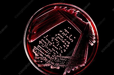Culture Of Staphylo Coccus Bacteria Stock Image B234 0013 Science Photo Library