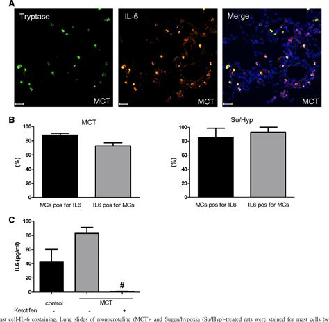 Figure 1 From The Mast Cell B Cell Axis In Lung Vascular Remodeling And Pulmonary Hypertension