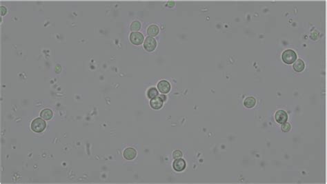 Detail Of Microscopic Observation Of A Malolactic Fermentation Carried Download Scientific