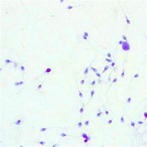 Eosine Nigrosine Pour La Mobilité Des Spermatozoïdes
