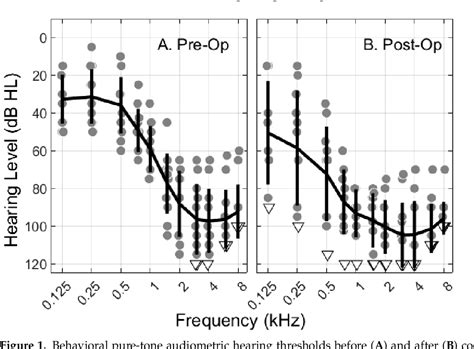 Figure 1 From Evaluation Of Real Time Intracochlear Electrocochleography For Guiding Cochlear
