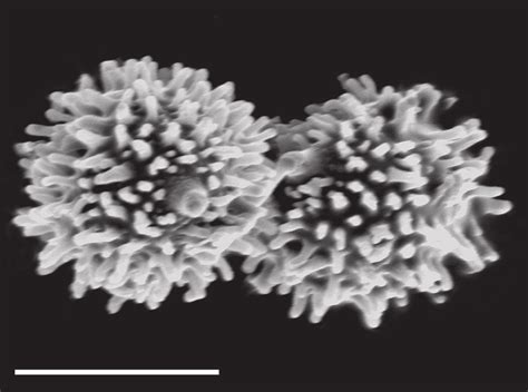 Spores Of Macowanites Rubroluteus Scale Bars 10 Mm Download