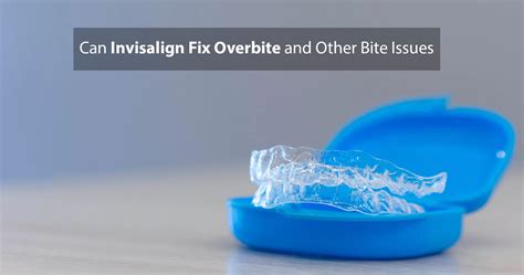 Can Invisalign Fix Overbites And Other Bite Issues Westhill Dental Centre