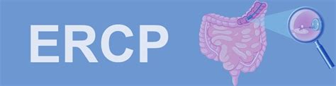 Ercp Procedure Uses And Risks