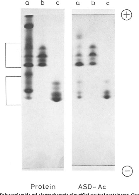 Figure 1 From In Vitro Stimulation Of Lymphocytes By Neutral Proteinases From Human