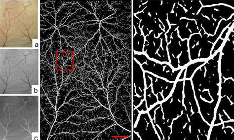 image processing — matlab number one