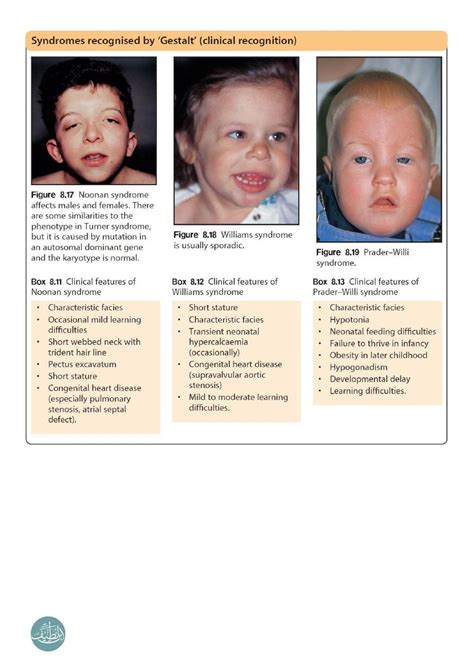 Dysmorphology Pdf Ibnlatef Muhadharaty