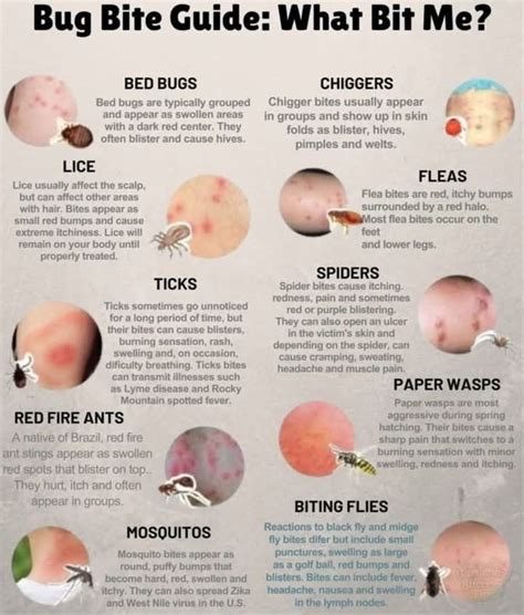Pin By Sherri Hicks On Helpful Things Bug Bites Bed Bugs Ant Bites