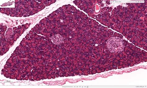 Endocrine Pathology Flashcards Quizlet