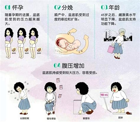 女性盆底肌松弛与康复治疗 官方网站
