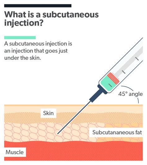 Subcutaneous Injection What Is It And How To Give One Ro