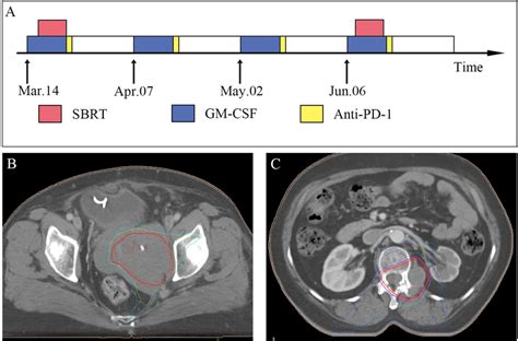A The Patients Treatment Schedule For 4 Cycles Subcutaneous Download Scientific Diagram