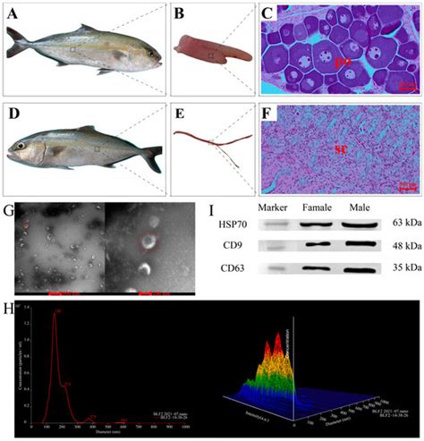 Sex Inclined Piwi Interacting Rnas In Serum Exosomes For Sex