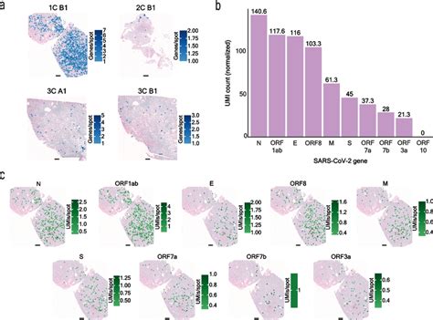 Spatial Distribution And Abundance Of Sars Cov 2 Gene Transcripts A