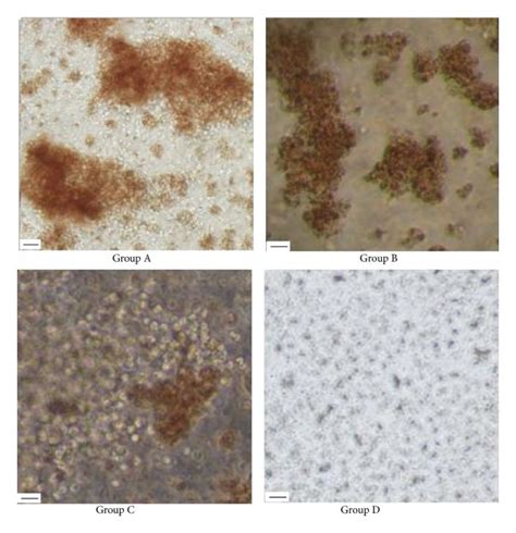 A The Colonies Were Observed In An Inverted Microscope Cfu Gemm Is